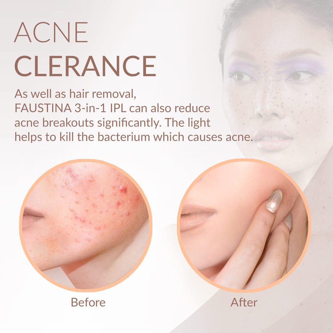 FAUSTINA 2,000,000 Shots IPL | LaboTest UK